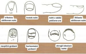 Kaj nohti povedo o vas? - Misteriji